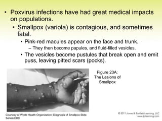 Viral Infections of the Respiratory Tract and Skin | PPT