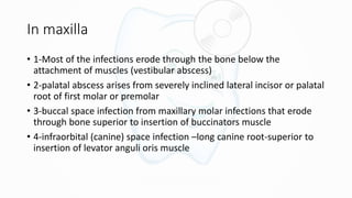 Principles of management and prevention of Odontogenic Infections | PPTX