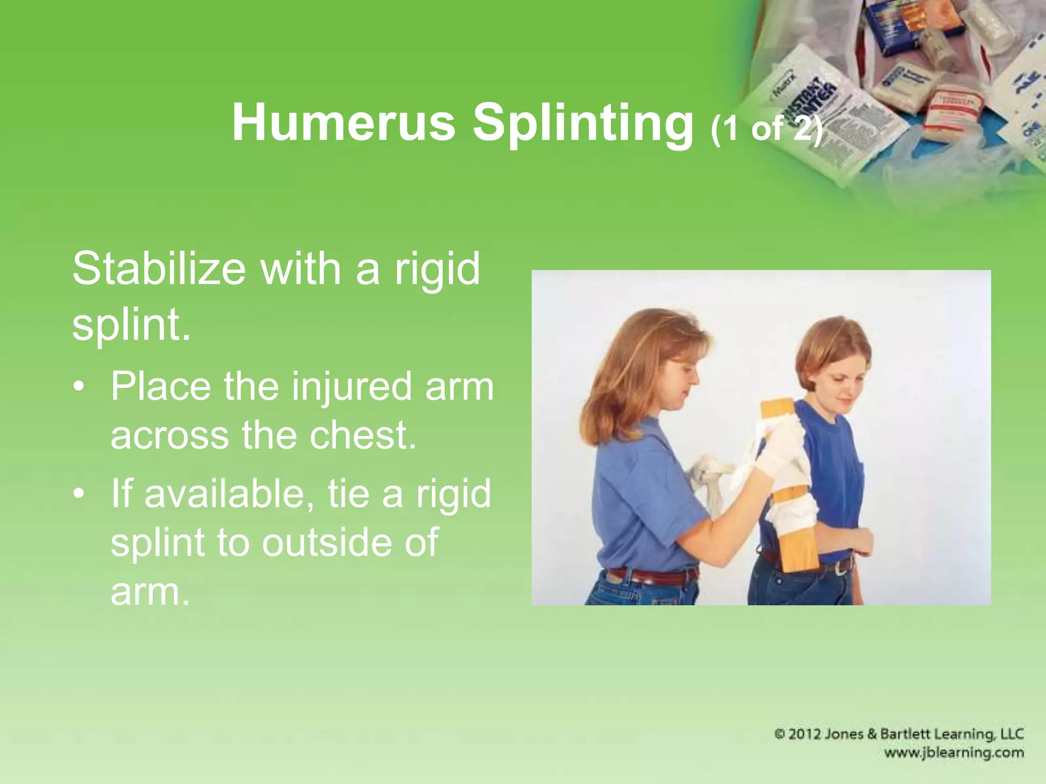Chapter 16 Splinting Extremeties | PPTX