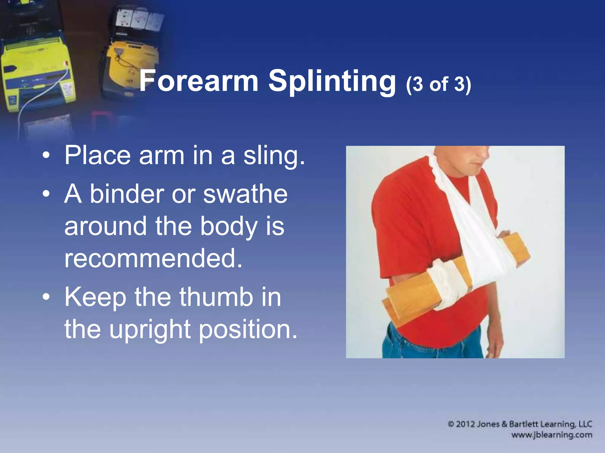Chapter 16 Splinting Extremeties | PPTX