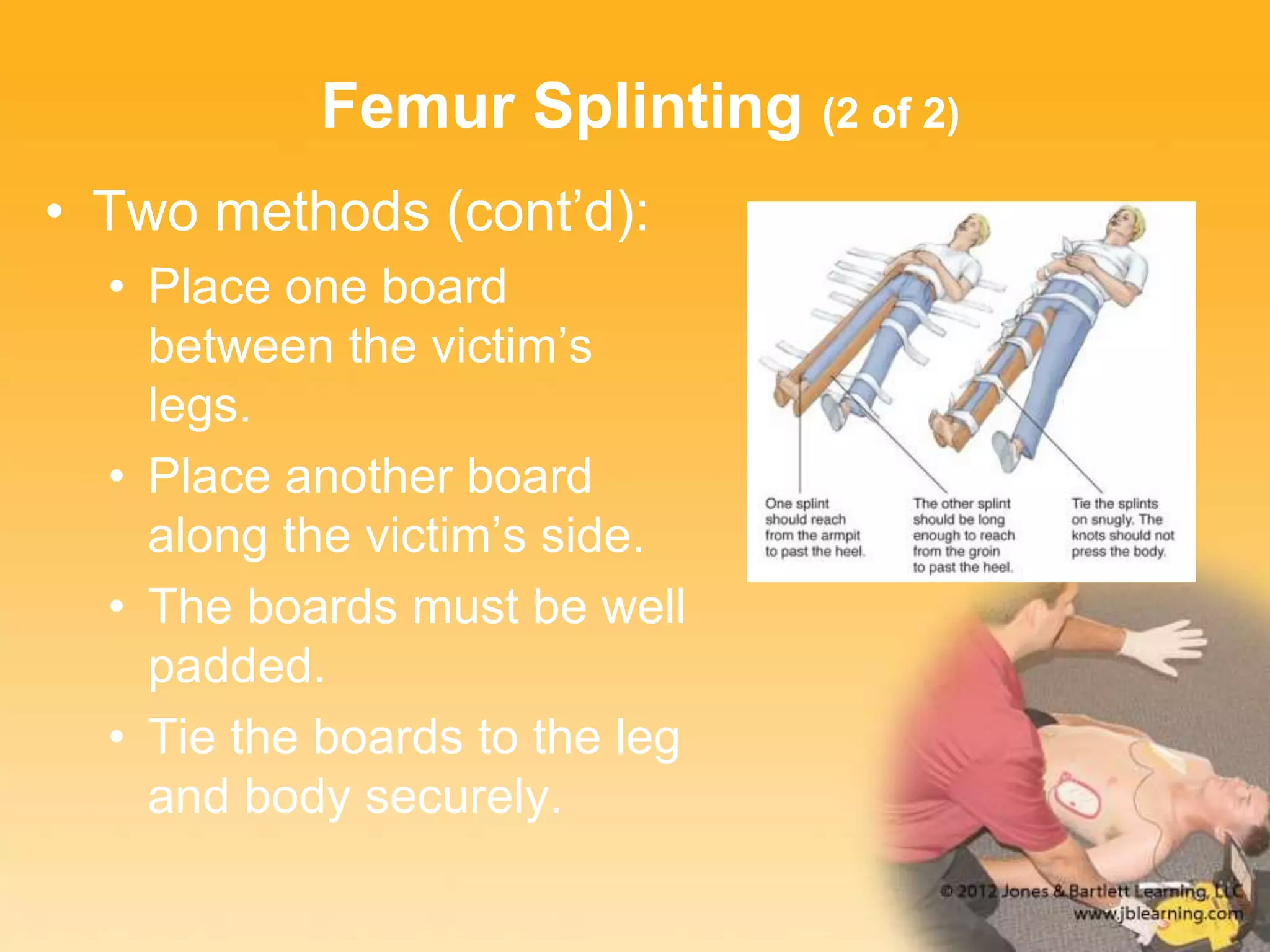 Chapter 16 Splinting Extremeties | PPTX