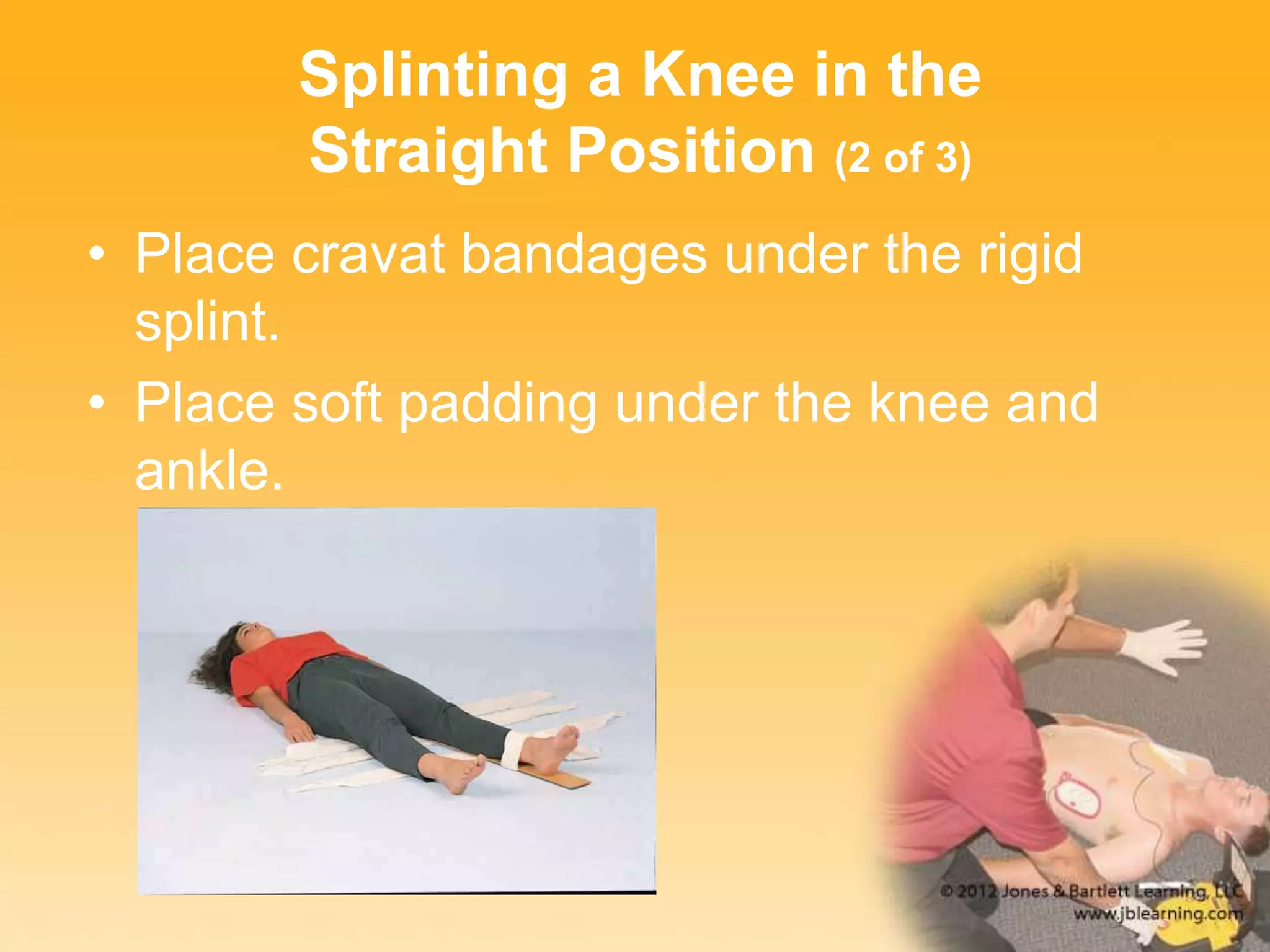 Chapter 16 Splinting Extremeties | PPTX
