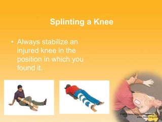 Chapter 16 Splinting Extremeties | PPTX