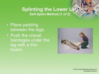 Chapter 16 Splinting Extremeties | PPTX