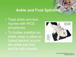 Chapter 16 Splinting Extremeties | PPTX