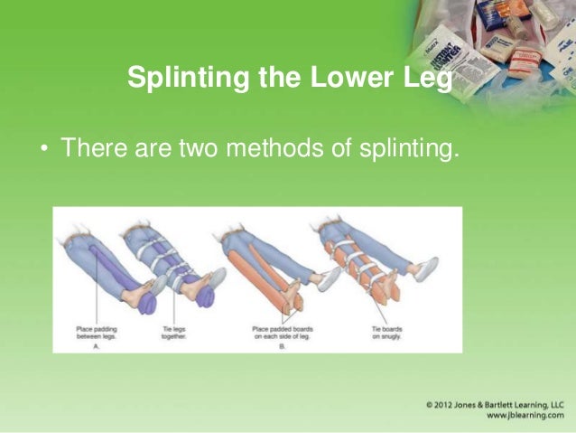 Chapter 16 Splinting Extremeties