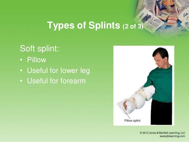 Chapter 16 Splinting Extremeties