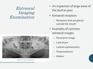 Chapter 16: Intro to Dental Imaging Examinations | PPT
