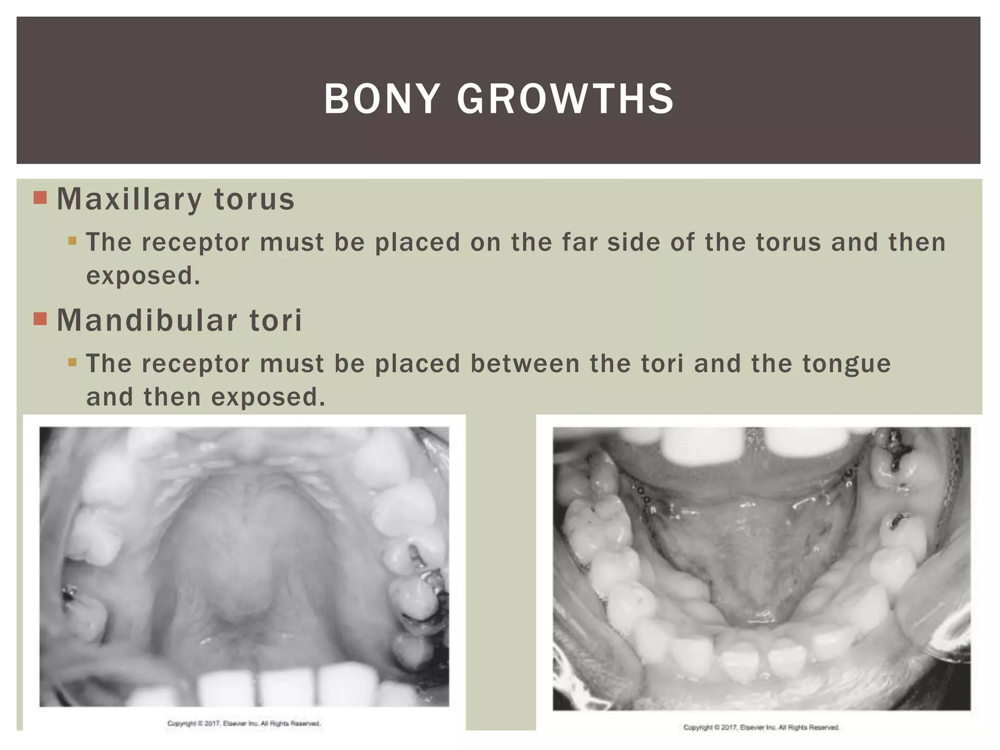 Chapter 17: Paralleling | PPT