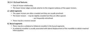 Chapter18.CLASS III MALOCCLUSIONS 123pptx | PPTX