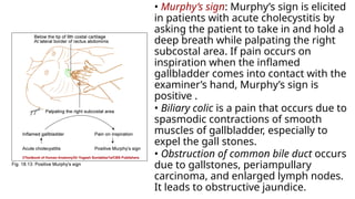 Extrahepatic Biliary Apparatus for medical students.pptx