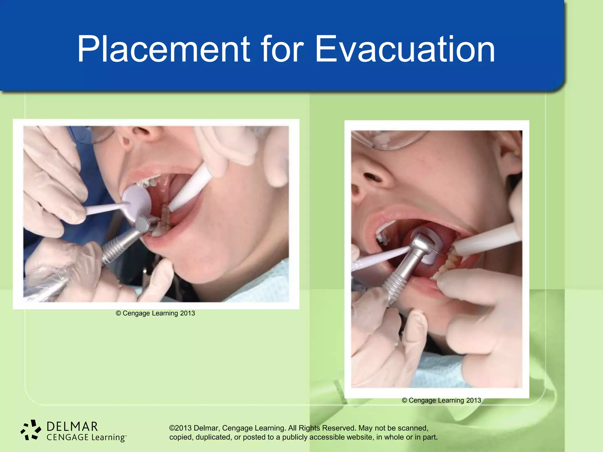 Instrument Transfer and Maintaining Operating Field | PPT