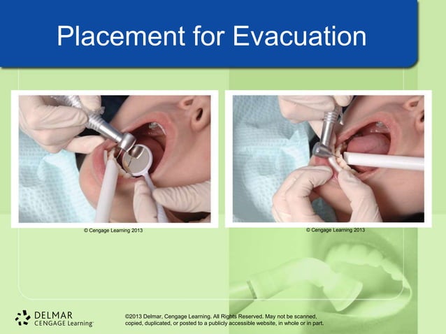 Instrument Transfer and Maintaining Operating Field | PPT