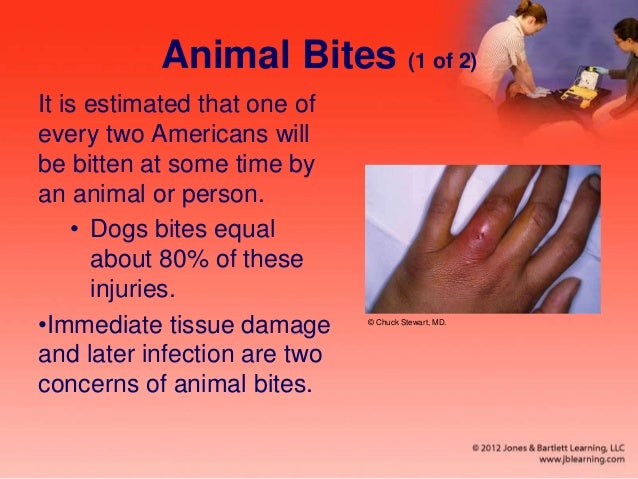 Chapter 19 Bites and Stings