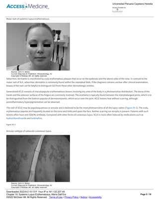 Chapter 19_ Systemic Lupus Erythematosus.pdf