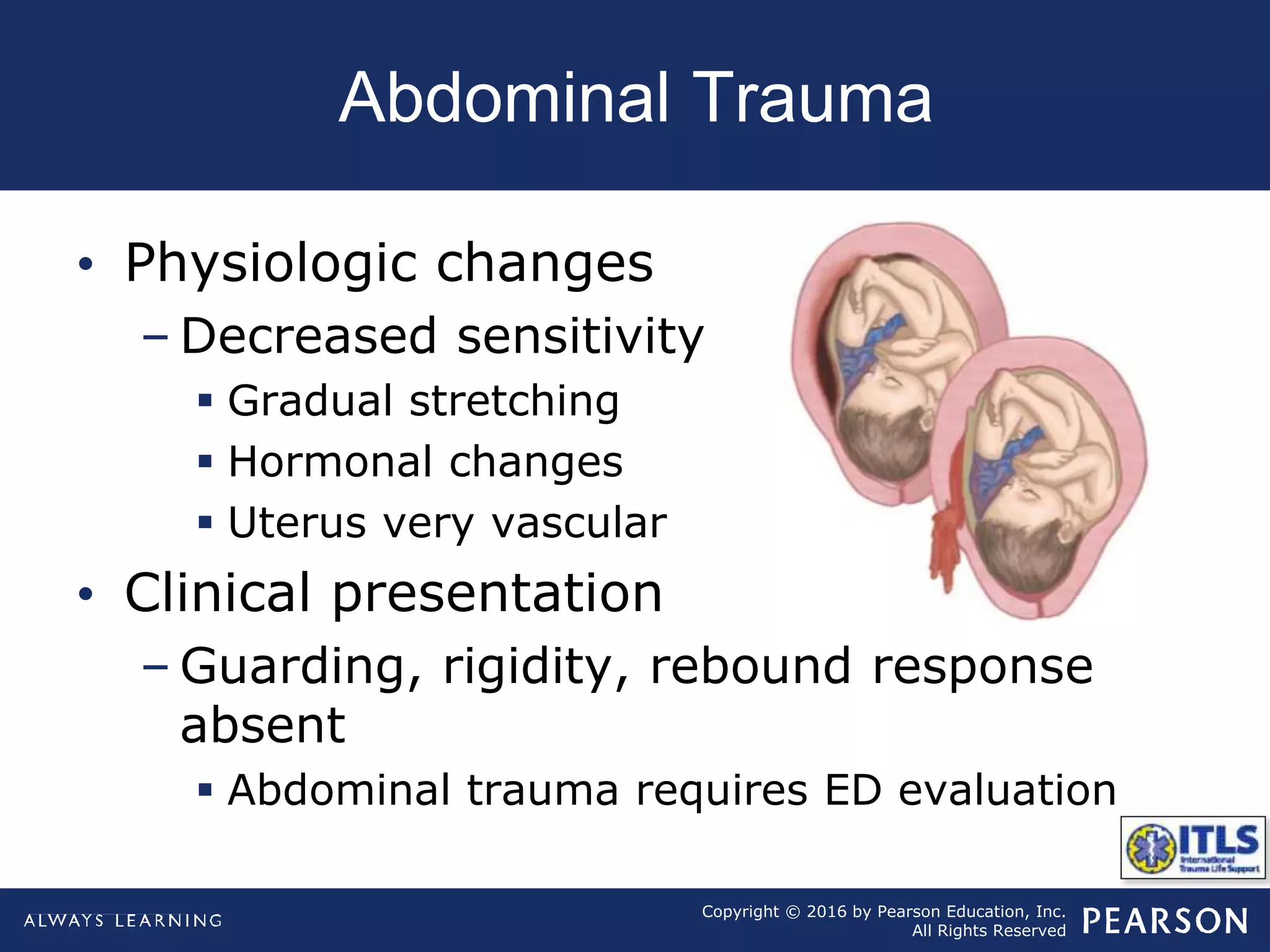 Chapter19 trauma in pregnancy | PPT