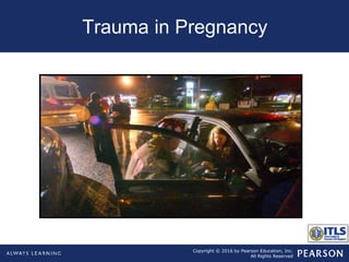 Chapter19 trauma in pregnancy | PPT