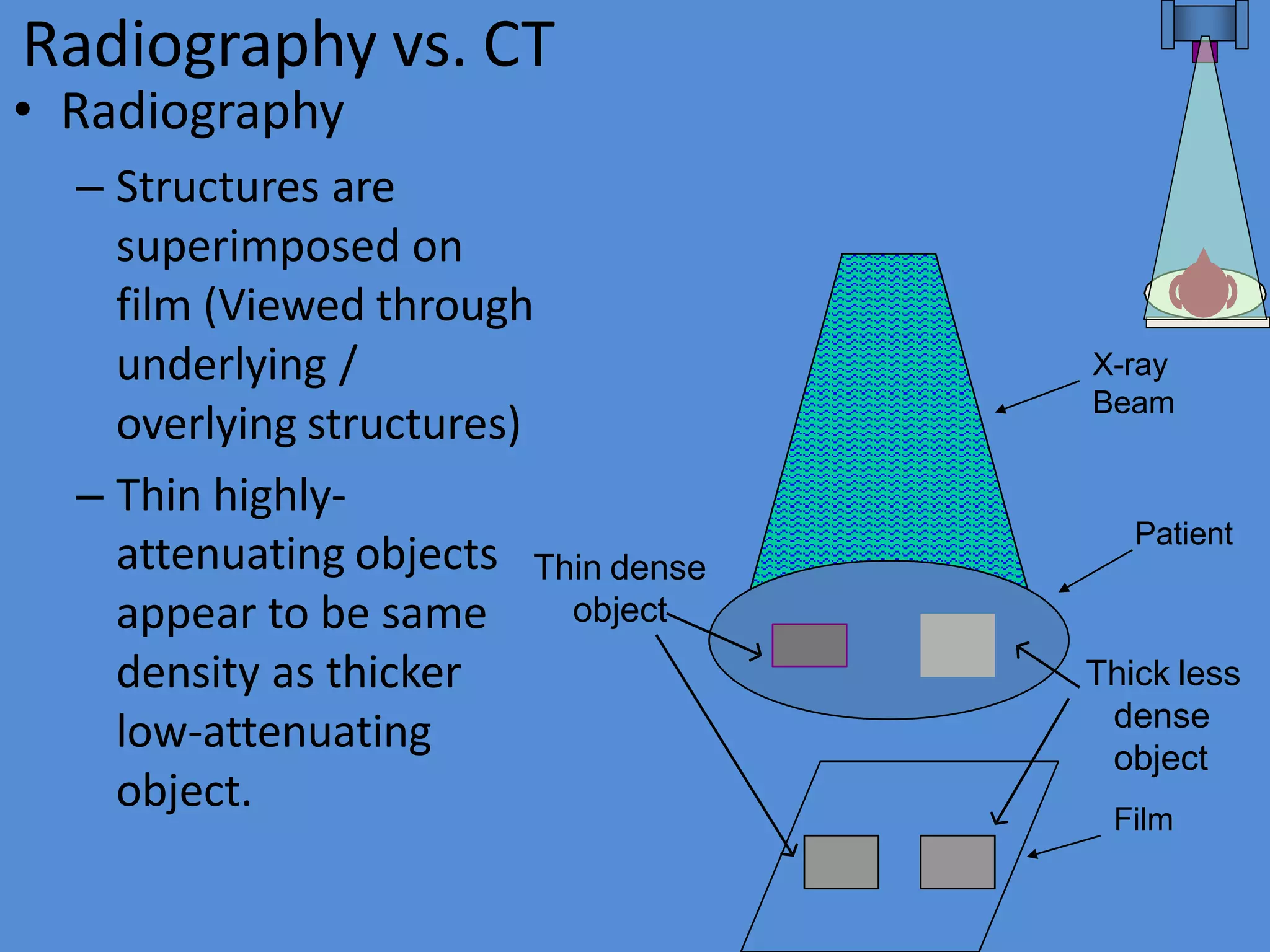 Chapter 1 basic principles of ct | PPTX