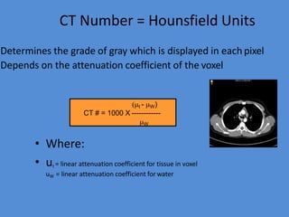 Chapter 1 basic principles of ct | PPTX