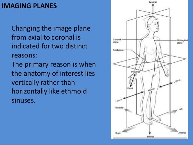 Chapter 1 basic principles of ct
