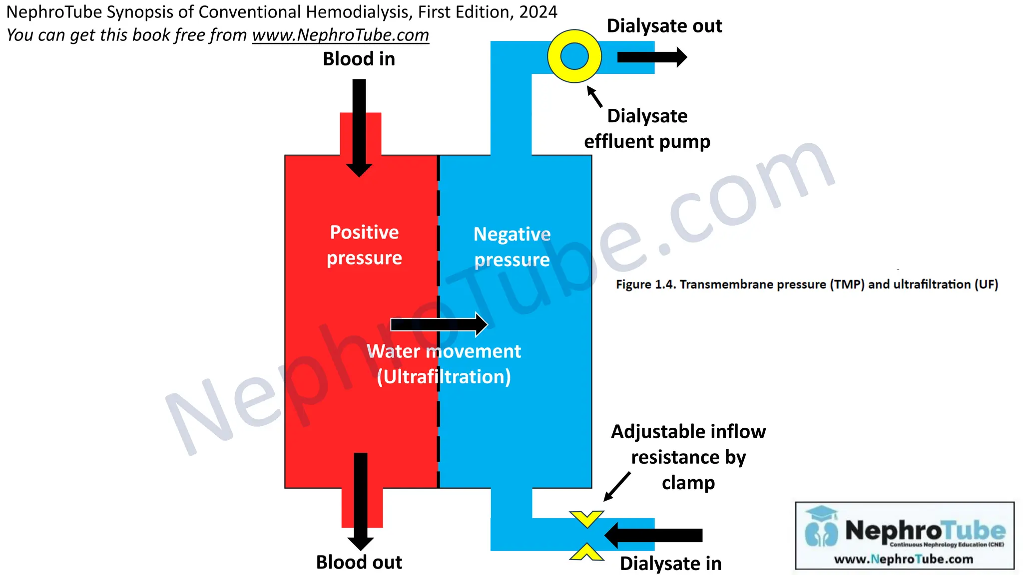 Hemodialysis: Chapter 1, Physiological Principles of Hemodialysis - Dr ...