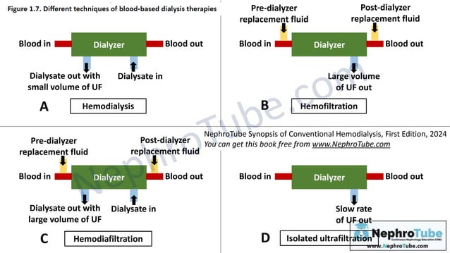 Hemodialysis: Chapter 1, Physiological Principles of Hemodialysis - Dr.Gawad | PDF | Blood ...