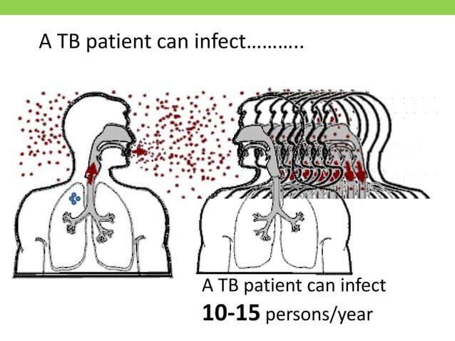 Chapter 1 understanding tb | PPT