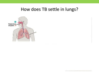 Chapter 1 understanding tb | PPTX | Lung and Respiratory Health ...