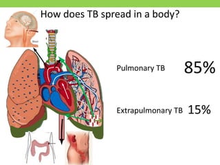 Chapter 1 understanding tb | PPTX | Lung and Respiratory Health ...