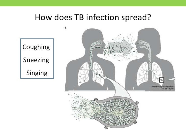 Tuberculosis at emaze Presentation