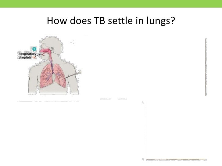 Chapter 1 understanding tb
