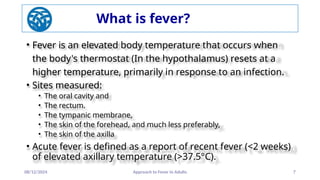 Chapter 2. Approach to Fever in Adults Draft.pptx
