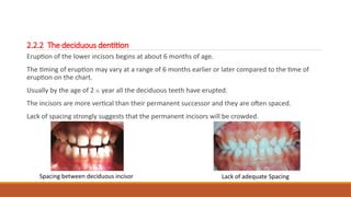 Chapter 2: Development of normal occlusion.pptx