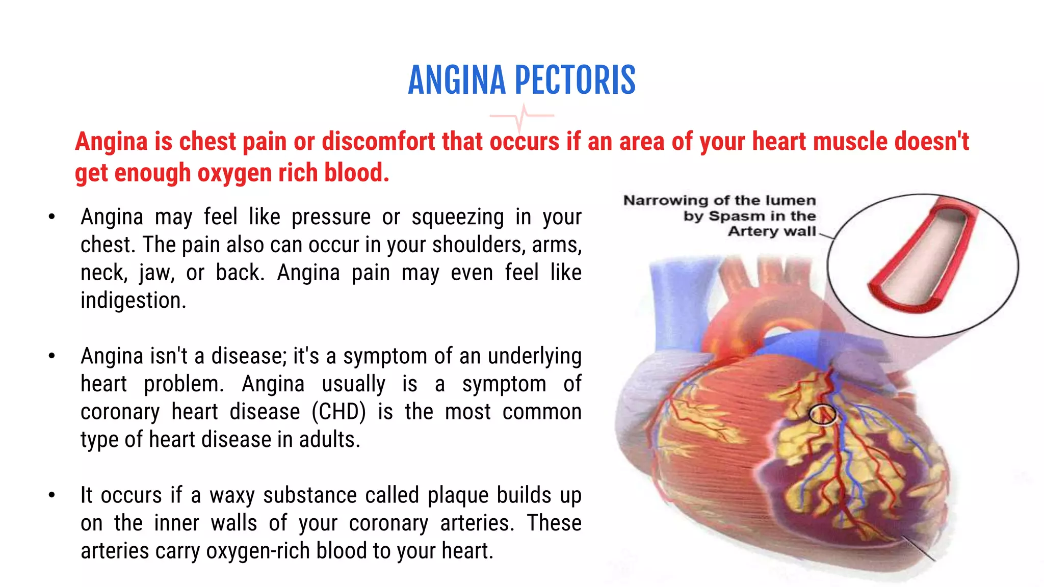 Angina pectoris and myocardial infraction.pptx