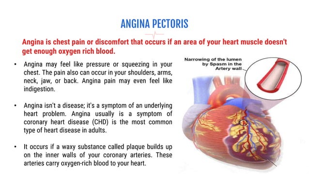Angina pectoris and myocardial infraction.pptx