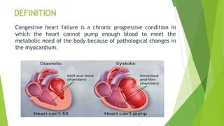 Congestive Heart Failure | PDF