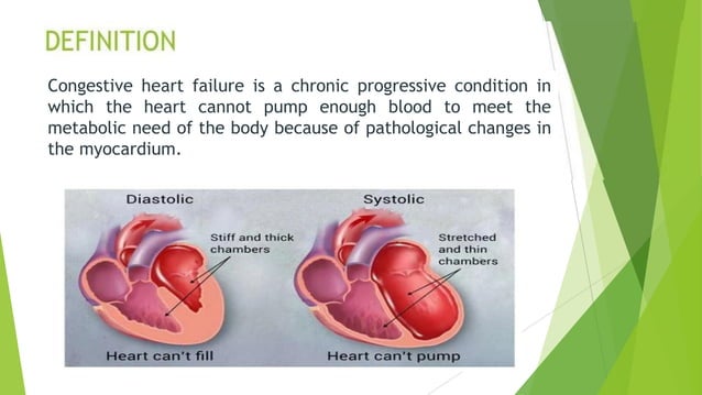 Congestive Heart Failure | PPT