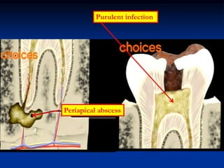 Dental caries and periodontal diseases.ppt
