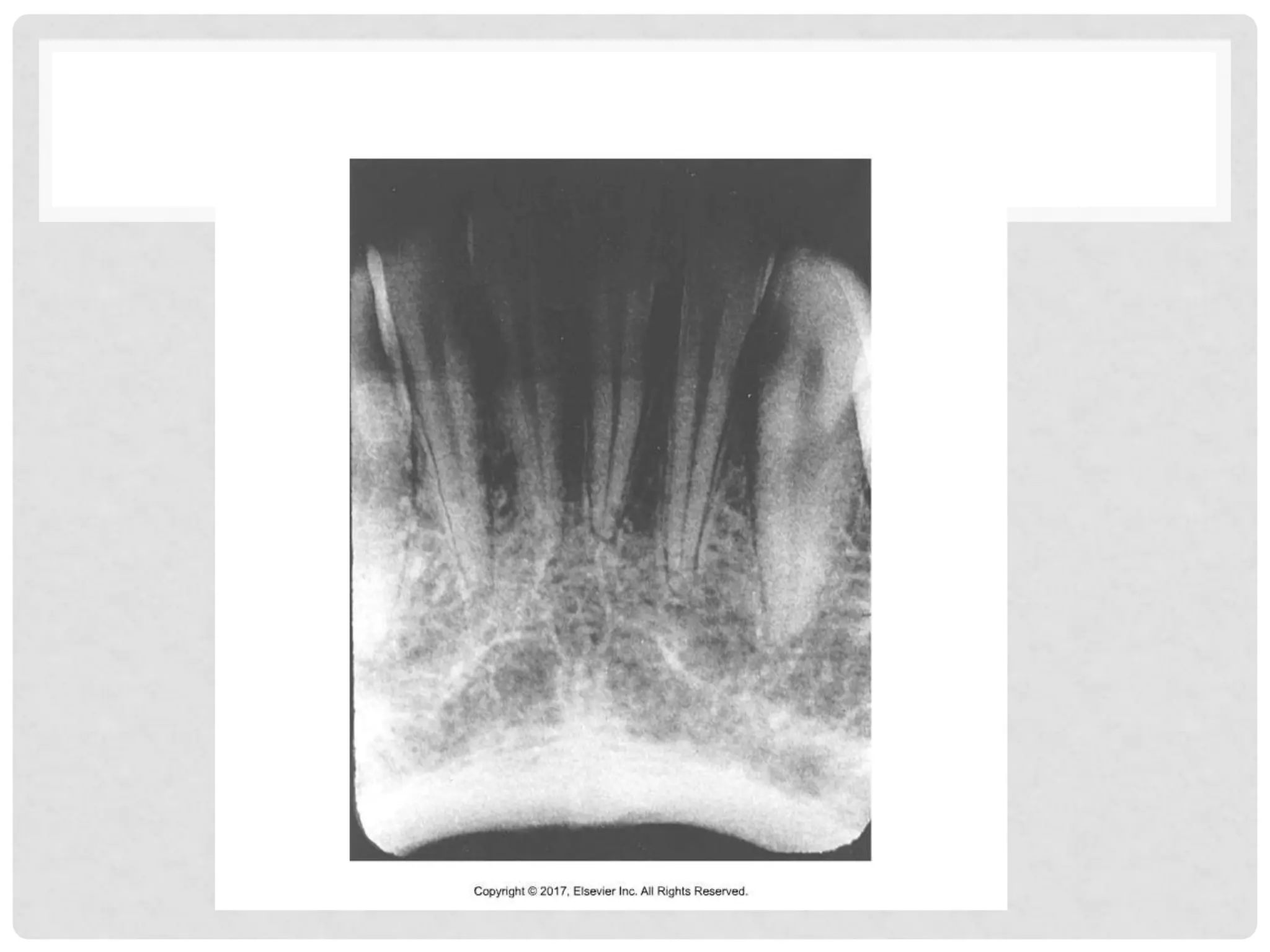 Chapter 20: Exposure and Technique Errors | PPT