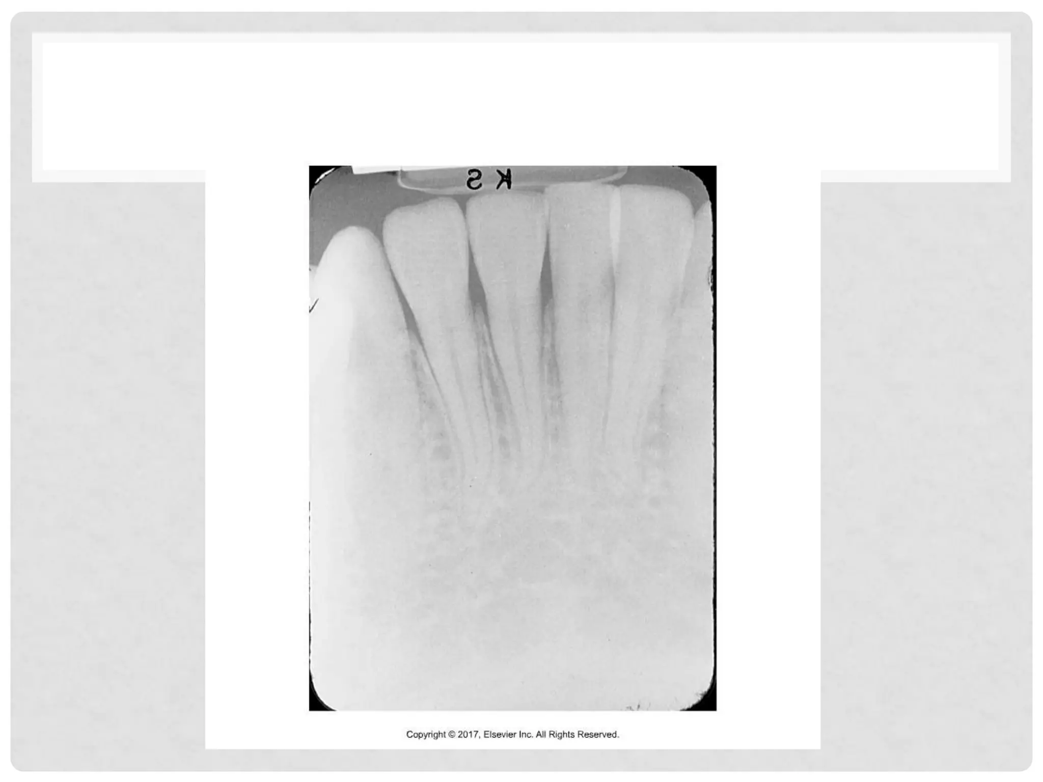 Chapter 20: Exposure and Technique Errors | PPT