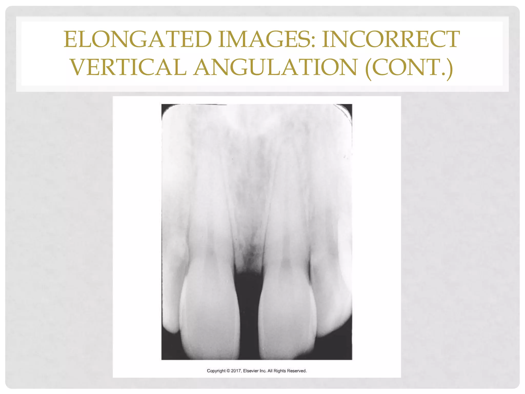 Chapter 20: Exposure and Technique Errors | PPT
