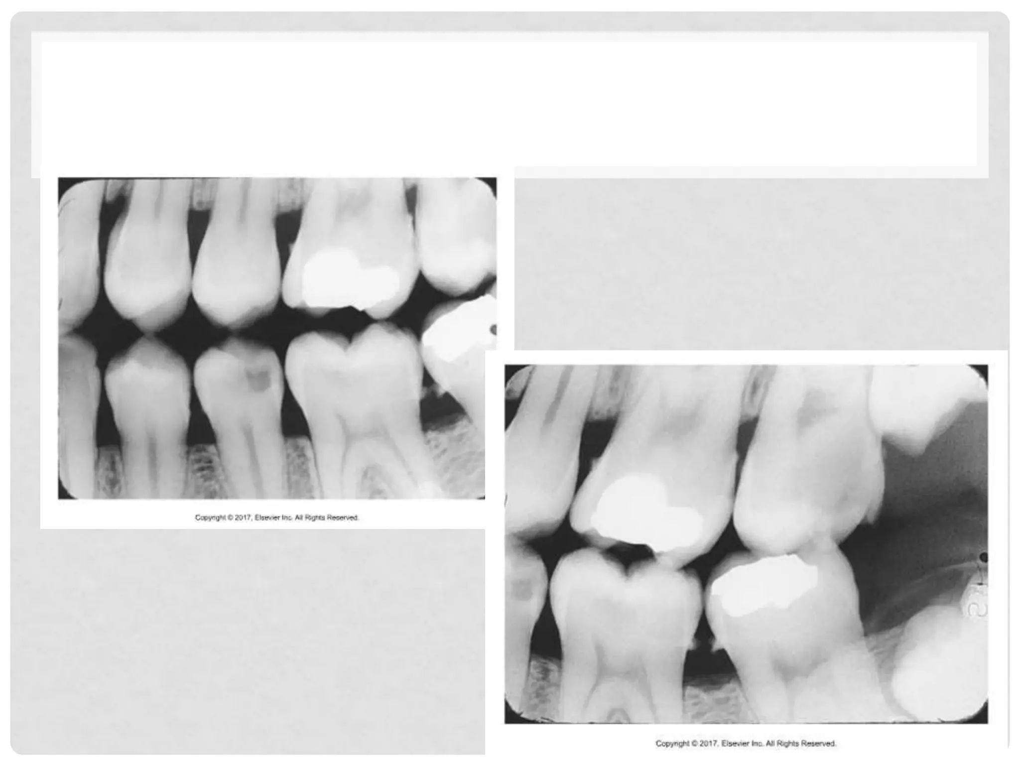 Chapter 20: Exposure and Technique Errors | PPT