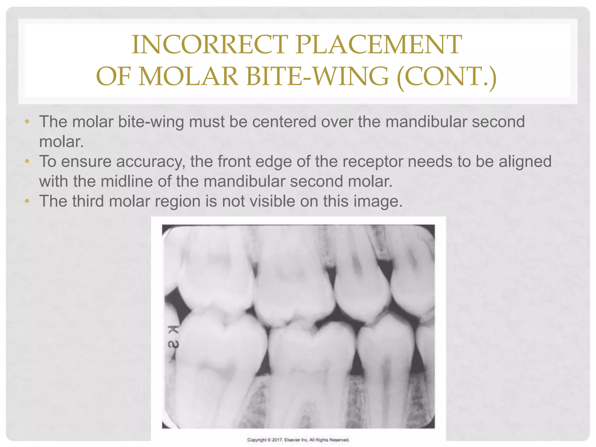 Chapter 20: Exposure and Technique Errors | PPT