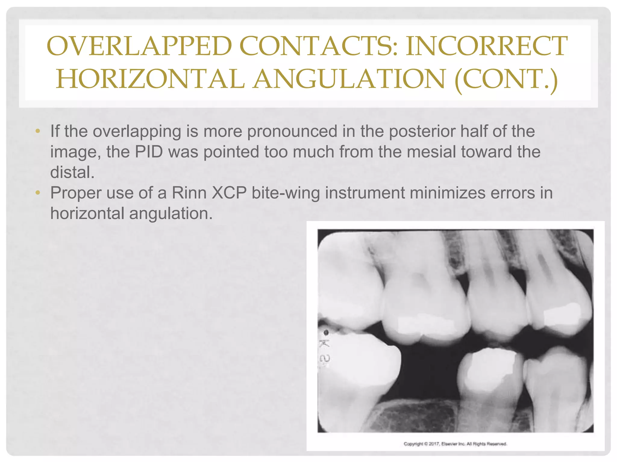Chapter 20: Exposure and Technique Errors | PPT