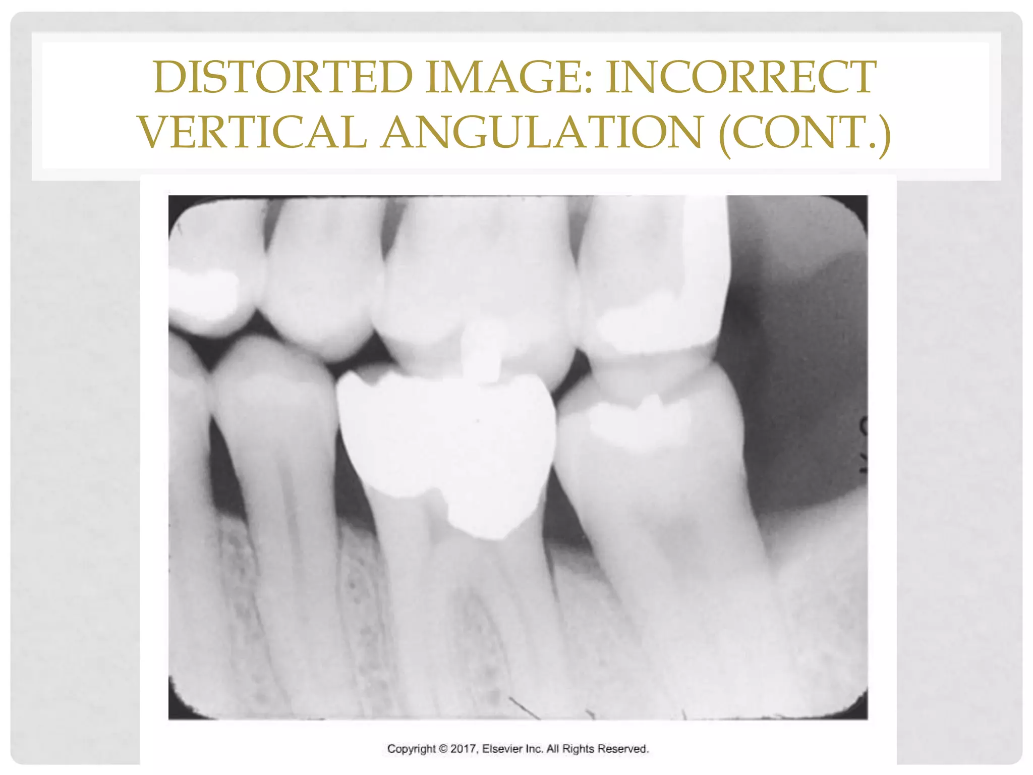 Chapter 20: Exposure and Technique Errors | PPT