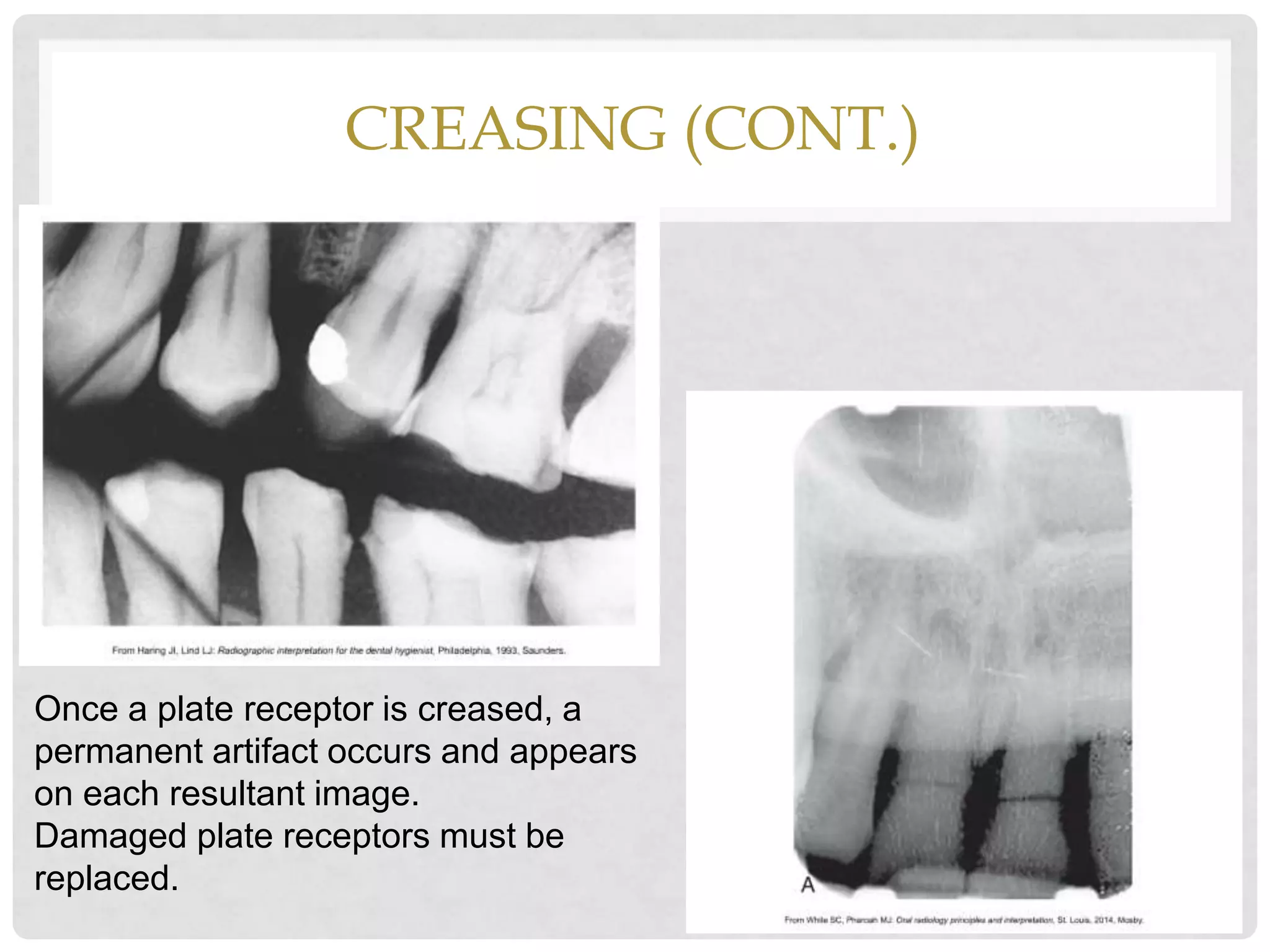 Chapter 20: Exposure and Technique Errors | PPT