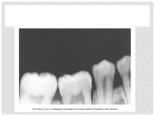Chapter 20: Exposure and Technique Errors | PPT