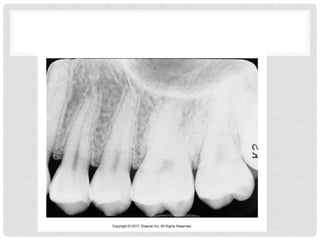 Chapter 20: Exposure and Technique Errors | PPT