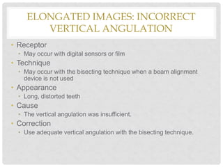Chapter 20: Exposure and Technique Errors | PPT