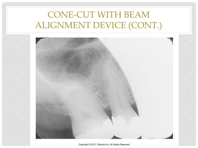 Chapter 20: Exposure and Technique Errors | PPT | Dental Health ...